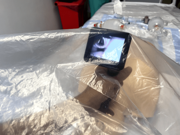 COVID-19: Protected Code Blue - REBEL EM - Emergency Medicine Blog