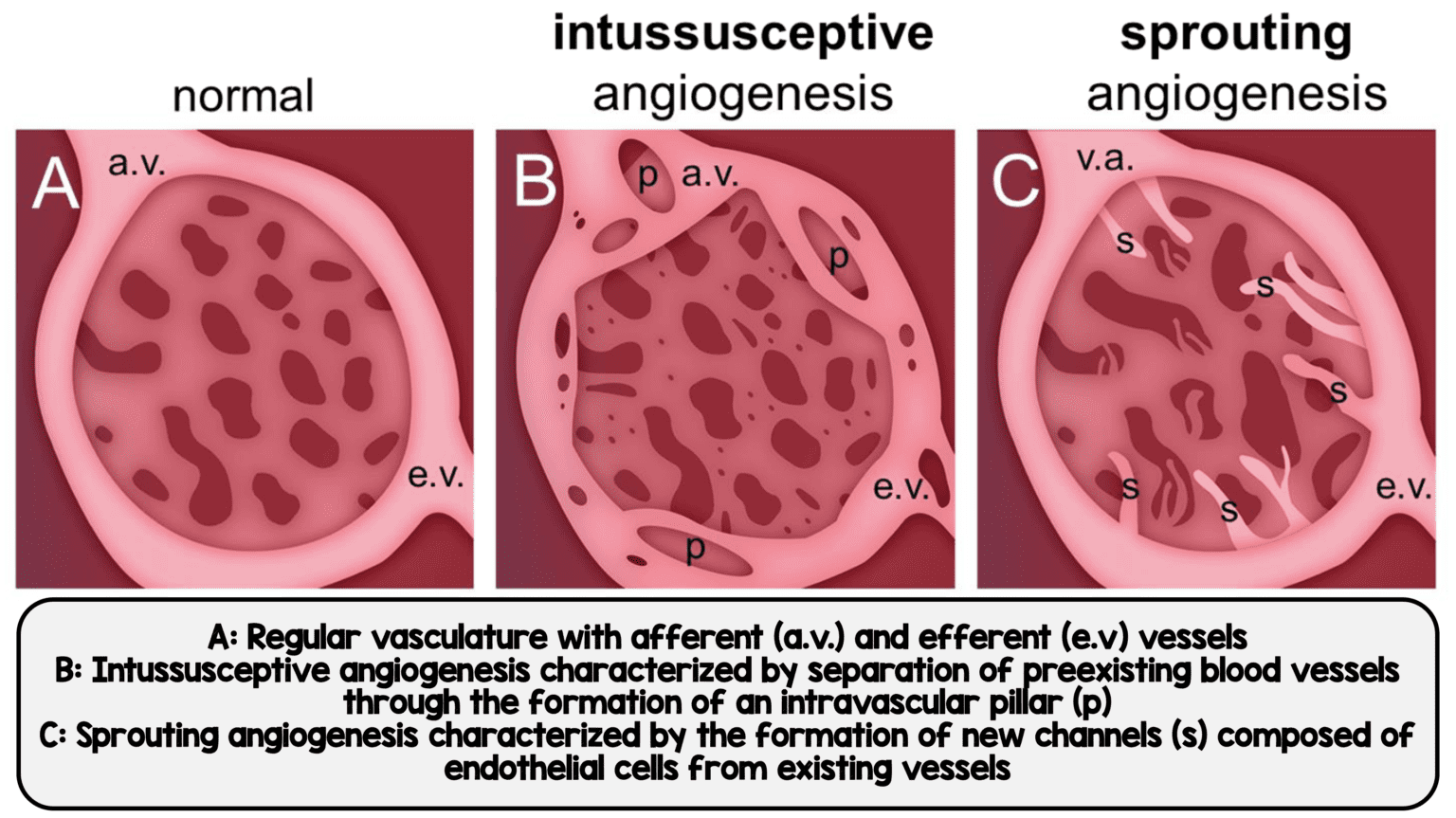 COVID19 - Intussusceptive and Sprouting Angiogenesis - REBEL EM ...