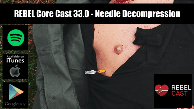 REBEL Core Cast 33.0 - Needle Decompression - REBEL EM - Emergency ...
