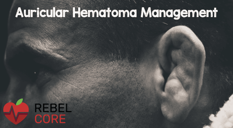 Auricular Hematoma Management - REBEL EM - Emergency Medicine Blog