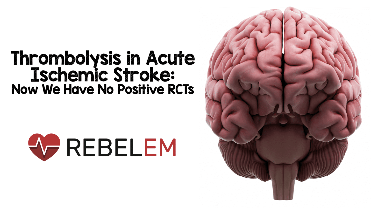 Thrombolysis - REBEL EM - Emergency Medicine Blog