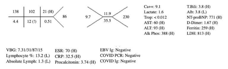 Multisystem Inflammatory Syndrome in Children (MIS-C) vs Kawasaki ...