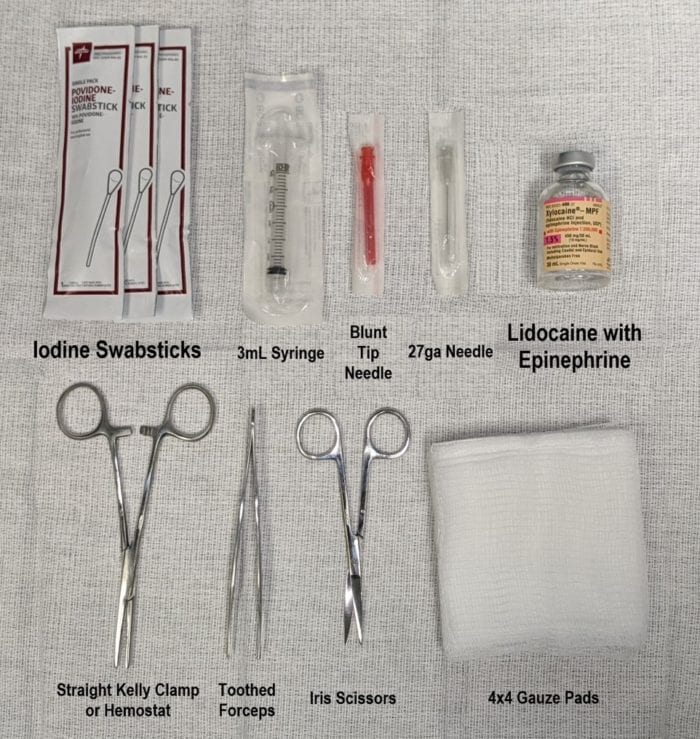 Orbital Compartment Syndrome: Pearls and Pitfalls for the ED Physician ...