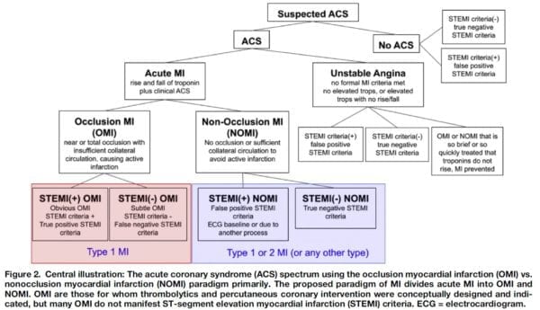 OMI-NOMI: Time for a Paradigm Shift - REBEL EM - Emergency Medicine Blog