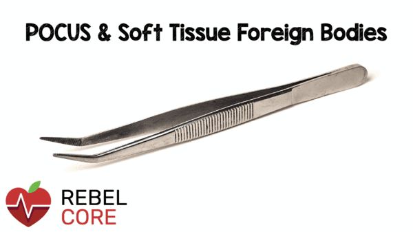 POCUS and Soft Tissue Foreign Bodies - REBEL EM - Emergency Medicine Blog