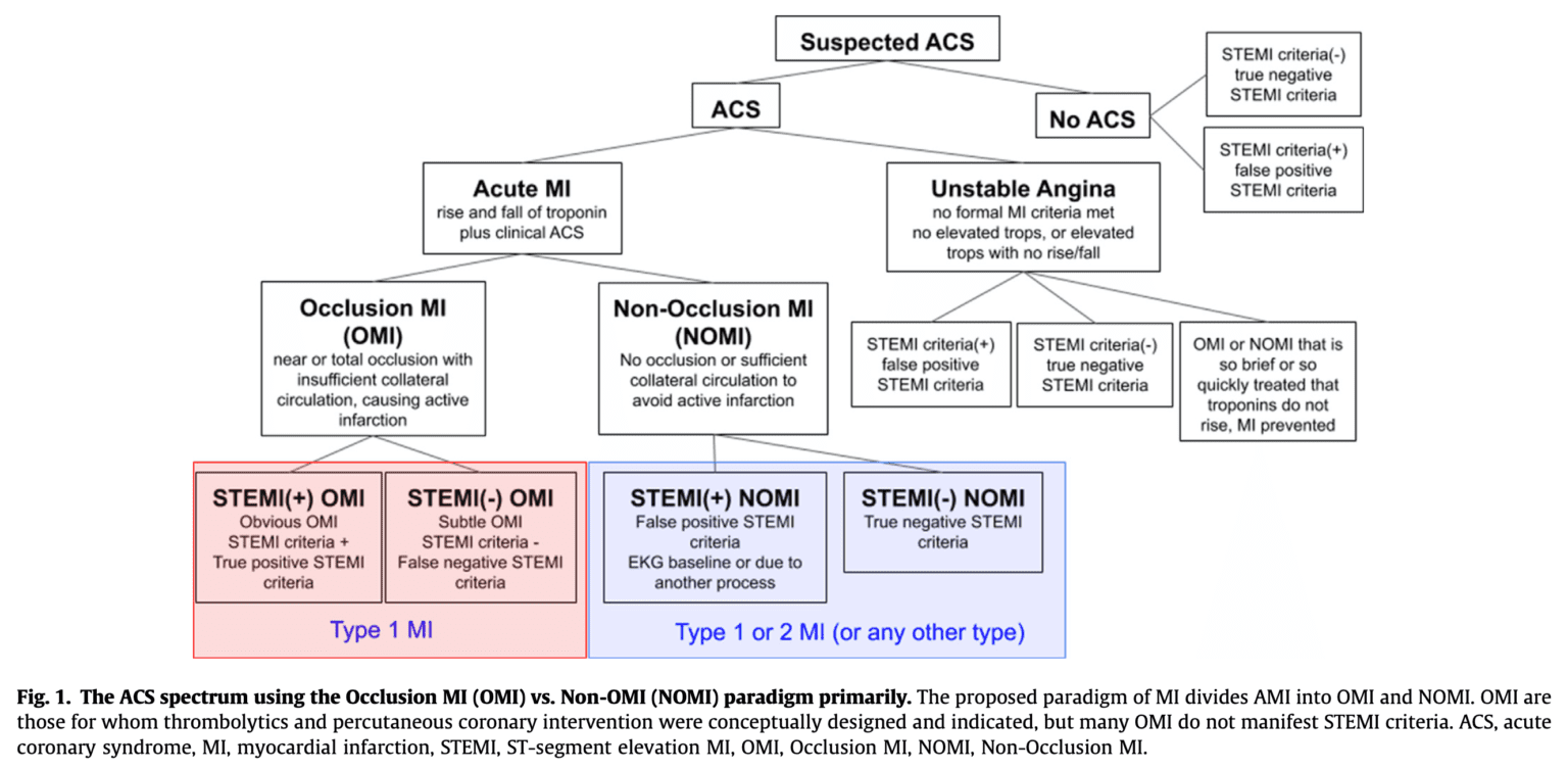 Upping Our ECG Game: OMI vs STEMI - REBEL EM - Emergency Medicine Blog