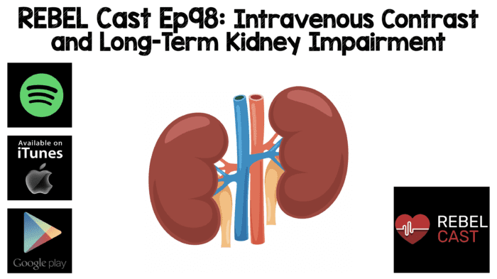REBEL Cast Ep98: Intravenous Contrast and Long-Term Kidney Impairment ...