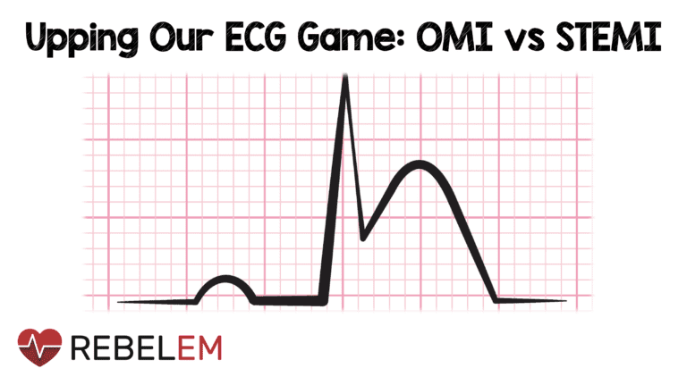 OMI - REBEL EM - Emergency Medicine Blog