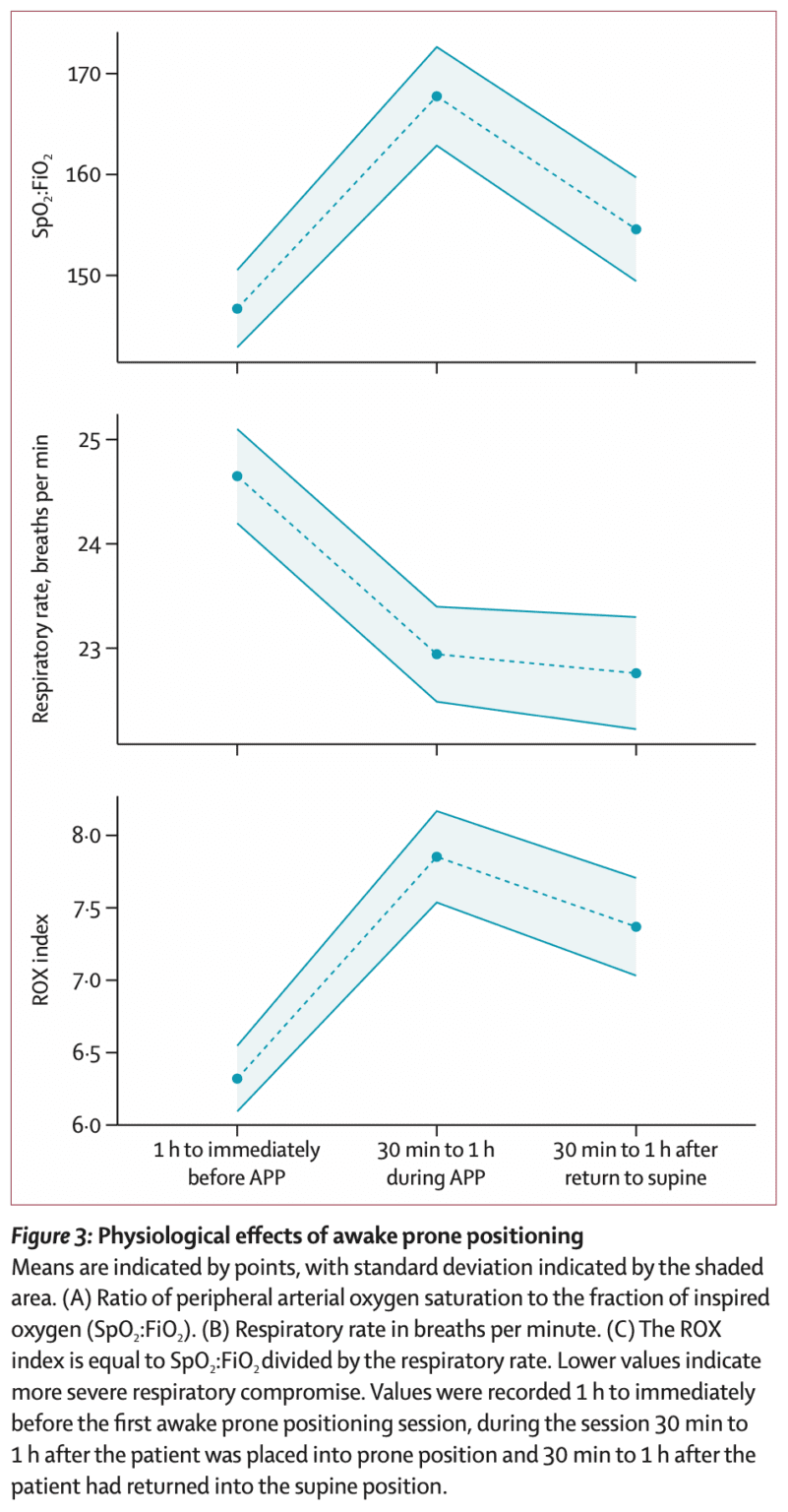 Awake Proning for COVID-19 Acute Hypoxemic Respiratory Failure - REBEL ...
