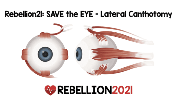 Rebellion21: SAVE the EYE – Lateral Canthotomy via Andy Little, DO ...