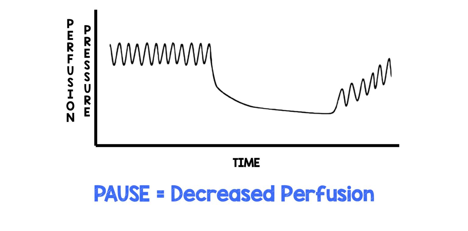 Pre-Charging the Defibrillator Before Rhythm Checks in Cardiac Arrest
