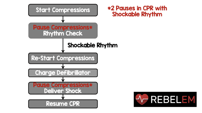 Standard Method of CPR - REBEL EM - Emergency Medicine Blog