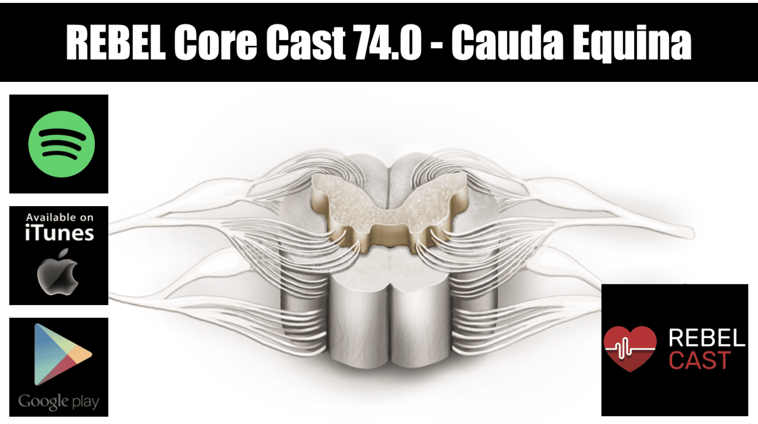 REBEL Core Cast 74.0 - Cauda Equina Syndrome - REBEL EM - Emergency ...