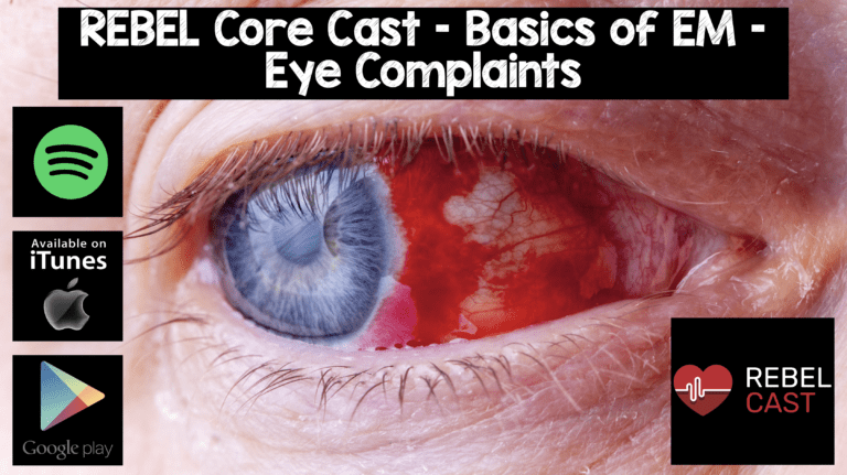 Basics of EM - Eye Complaints - REBEL EM - Emergency Medicine Blog