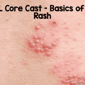 REBEL Core Cast – Basics of EM – Dizziness