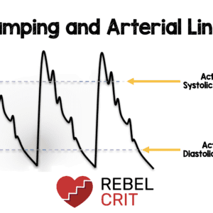 Damping and Arterial Lines