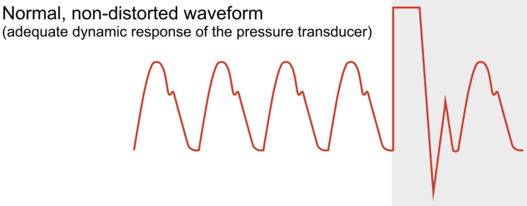 Damping and Arterial Lines - REBEL EM - Emergency Medicine Blog