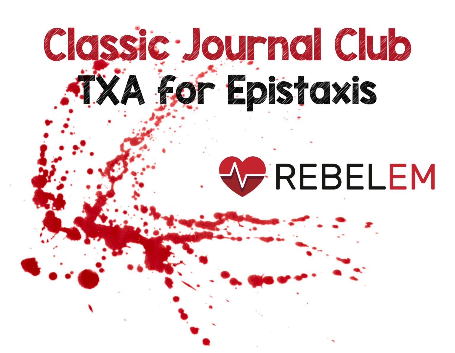 Classic Journal Club: TXA for Epistaxis - REBEL EM - Emergency Medicine ...