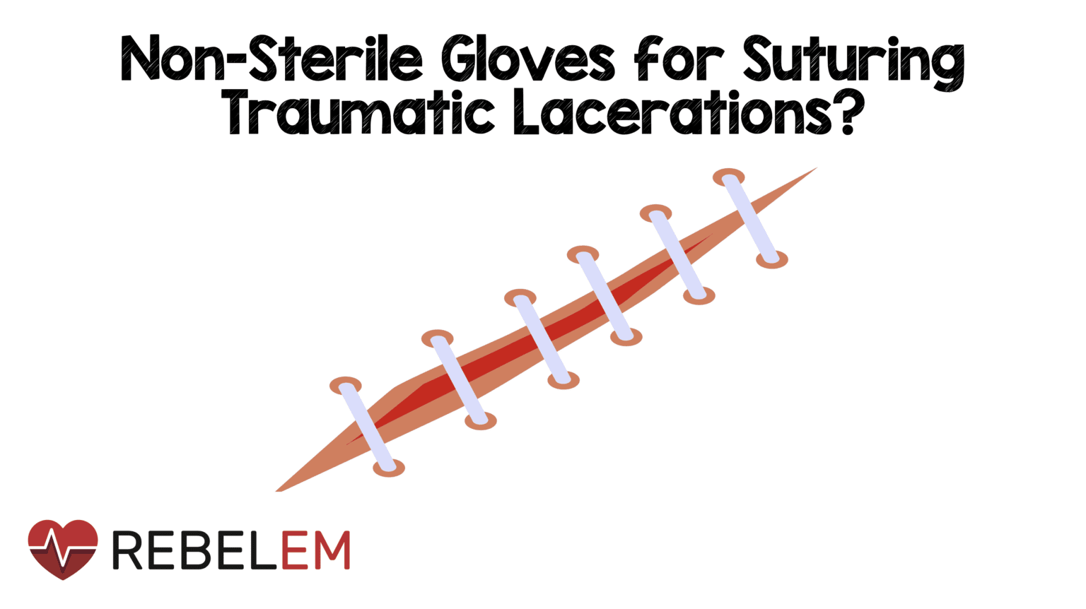 Non-Sterile Gloves for Suturing Traumatic Lacerations? - REBEL EM ...