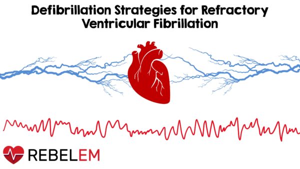 REBEL Cast Ep113: Defibrillation Strategies for Refractory Ventricular ...