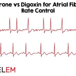 Amiodarone Versus Digoxin for Acute Rate Control of Atrial Fibrillatio ...