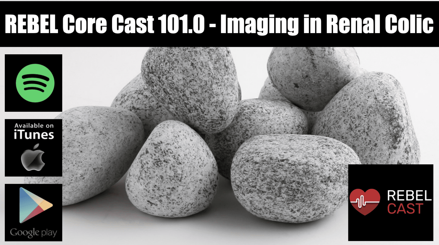 REBEL Core Cast 101.0 - Imaging in Renal Colic - REBEL EM - Emergency ...