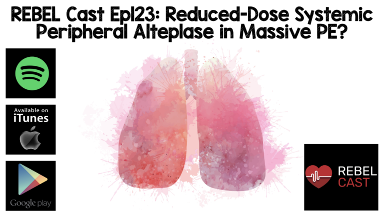 REBEL Cast Ep123: Reduced-Dose Systemic Peripheral Alteplase in Massive ...