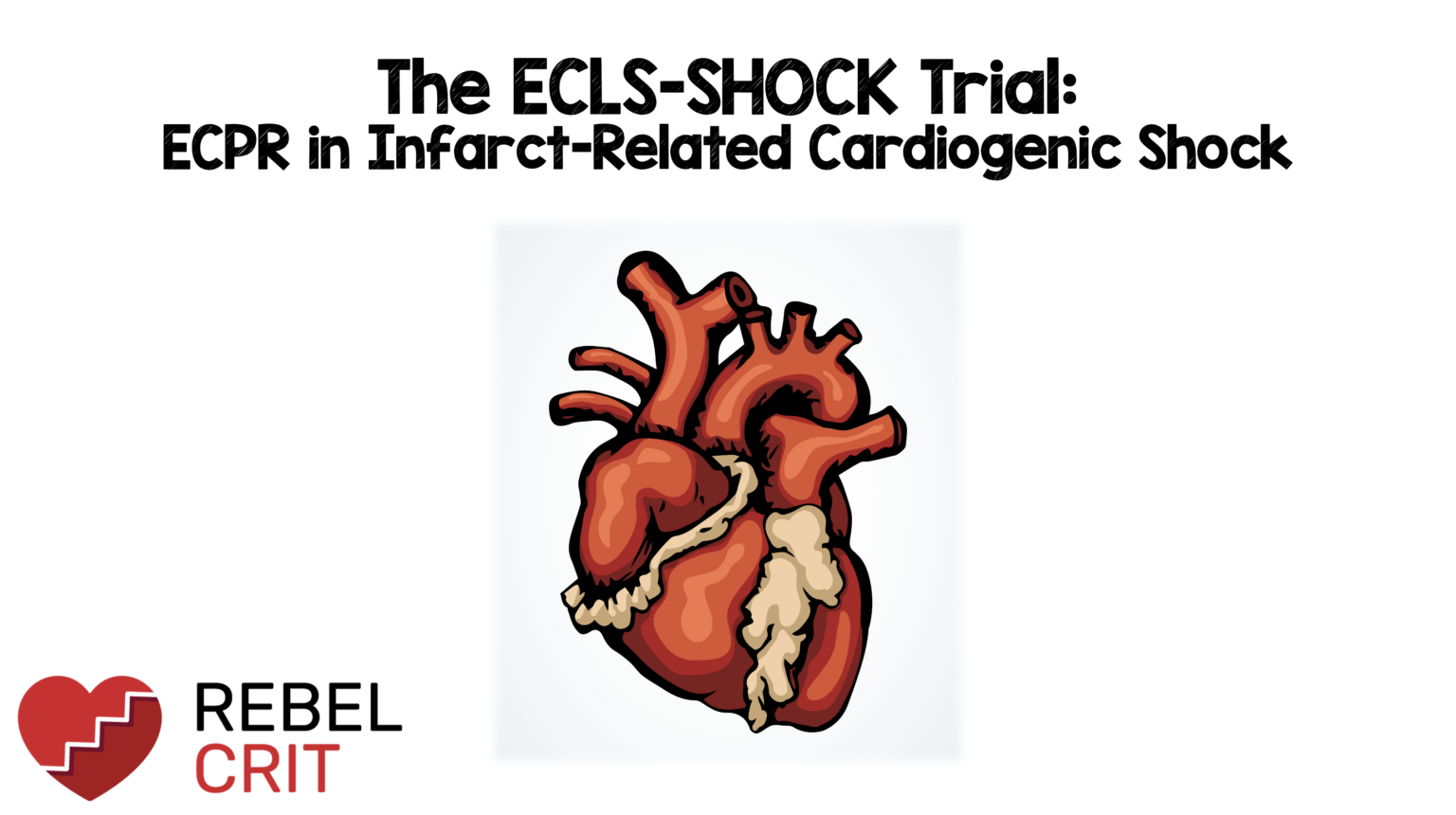 The ECLS-SHOCK Trial: ECPR in Infarct-Related Cardiogenic Shock - REBEL ...