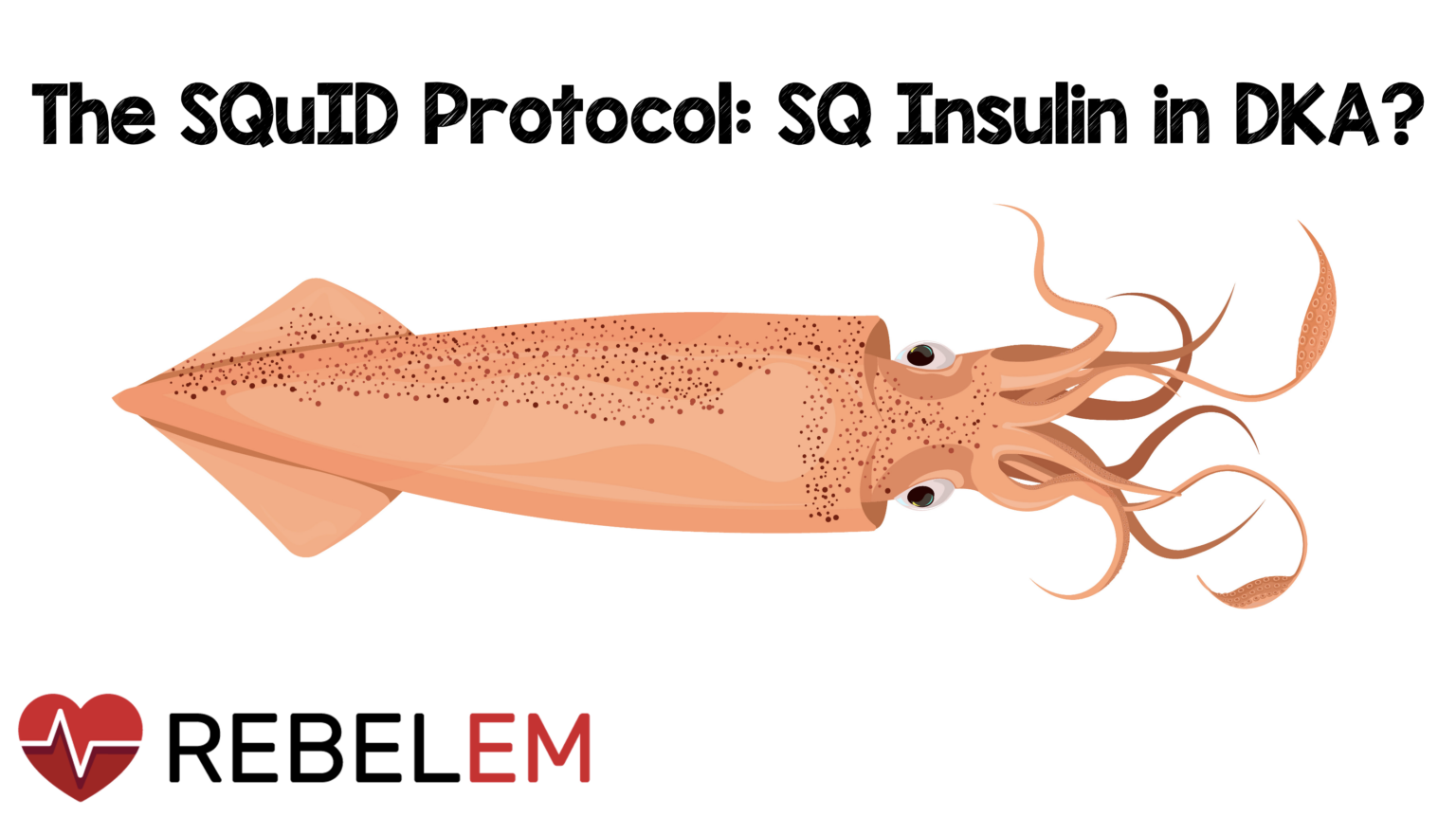 The SQuID Protocol: SQ Insulin in DKA? - REBEL EM - Emergency Medicine Blog