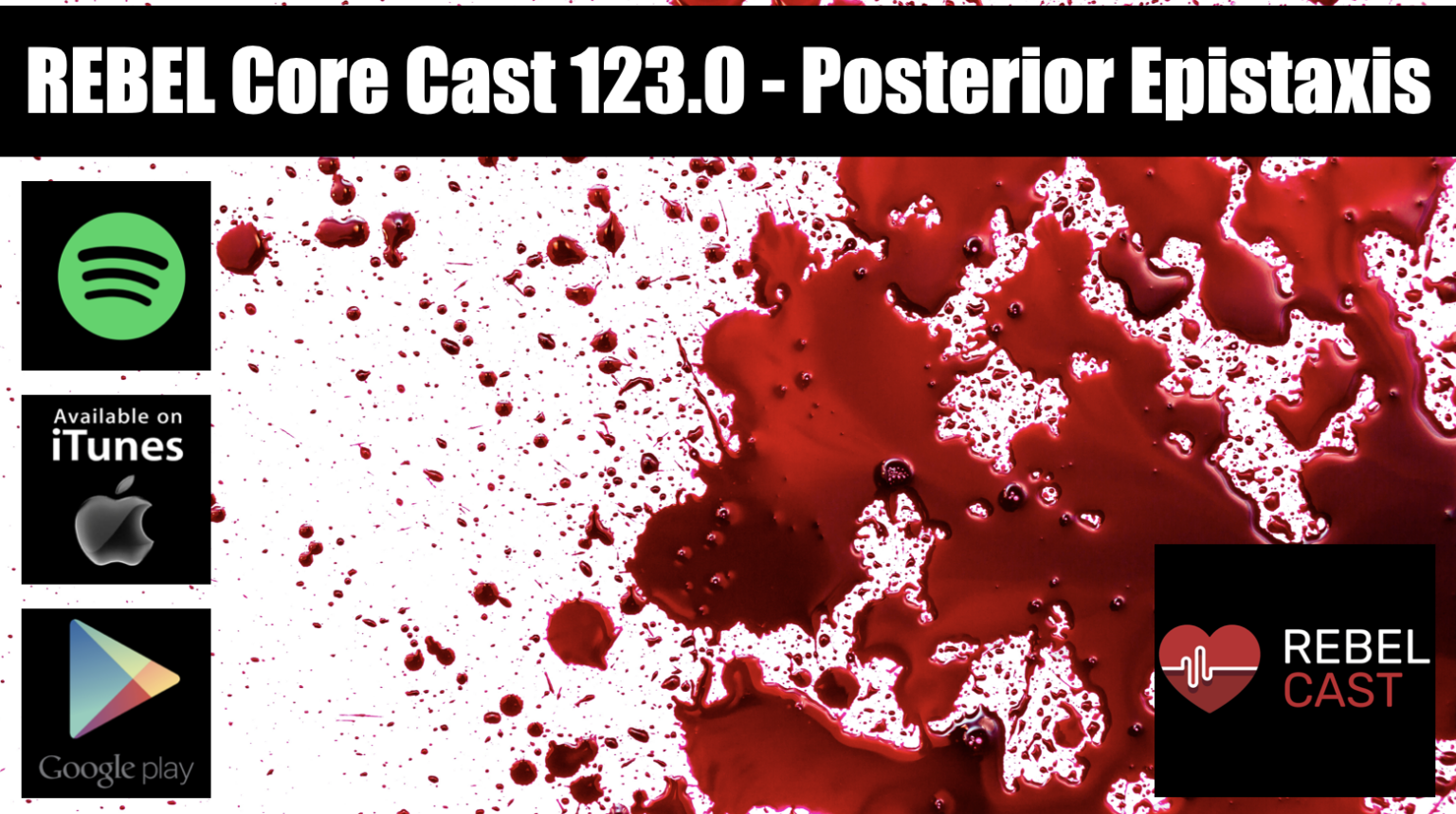 REBEL CAST - REBEL EM - Emergency Medicine Blog