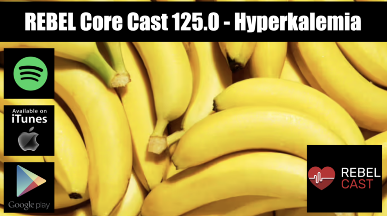REBEL Core Cast 125.0 - Hyperkalemia - REBEL EM - Emergency Medicine Blog