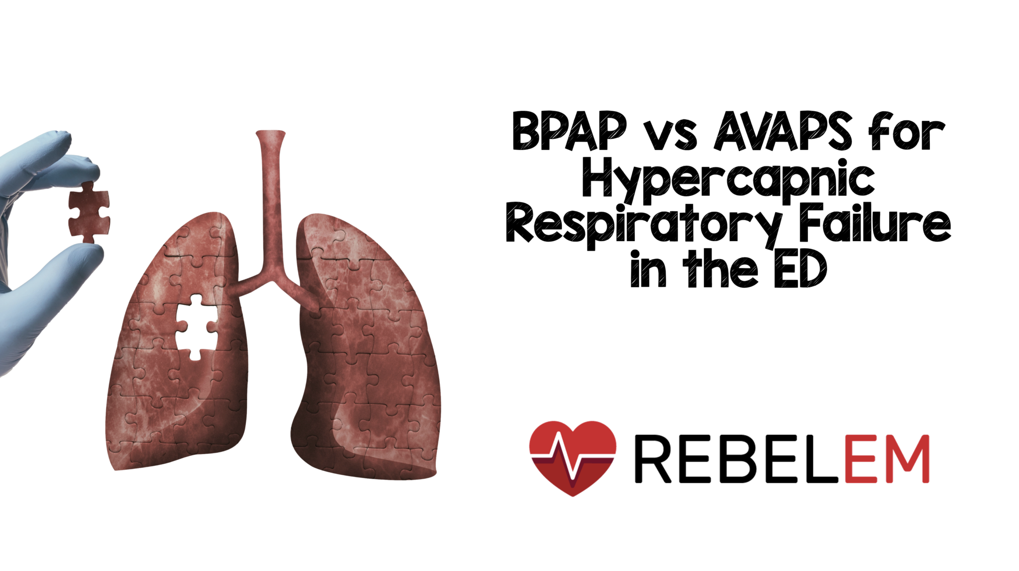 BPAP vs AVAPS for Hypercapnic Respiratory Failure in the ED - REBEL EM ...