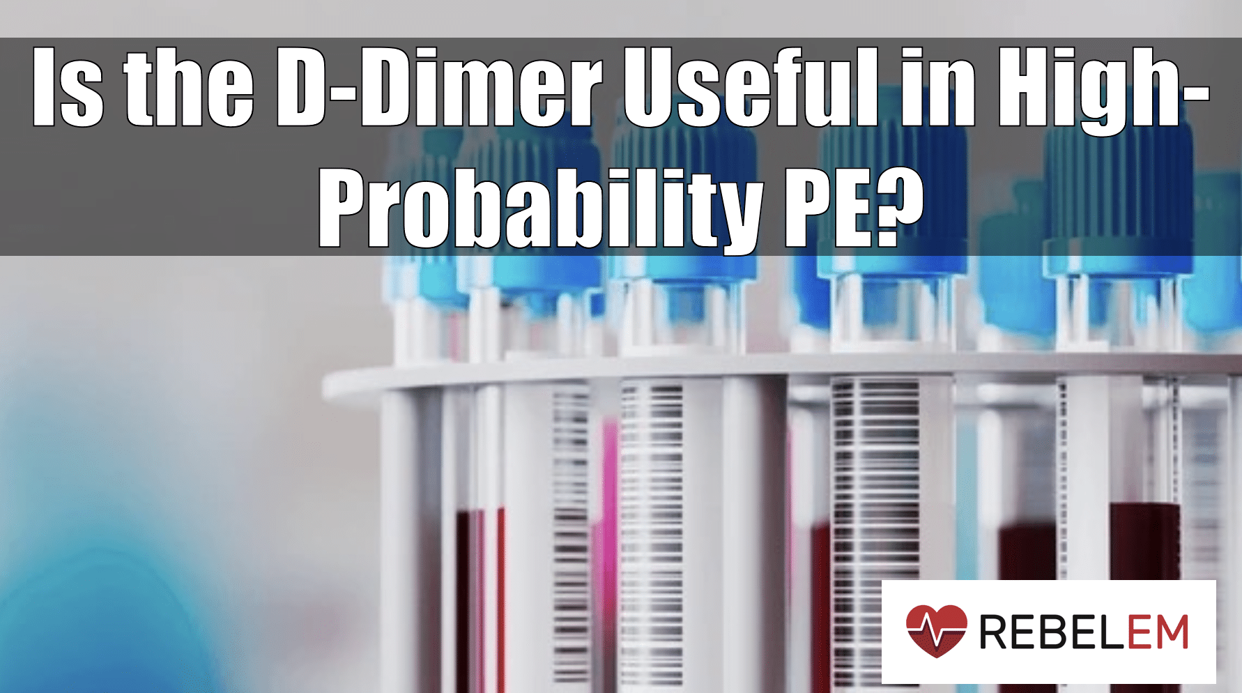 Is the D-Dimer Useful in High-Probabilty Pulmonary Embolism? - REBEL EM ...