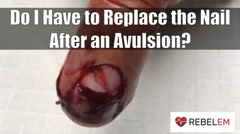 Clinical Conundrum: Do I Have to Replace the Nail After an Avulsion ...
