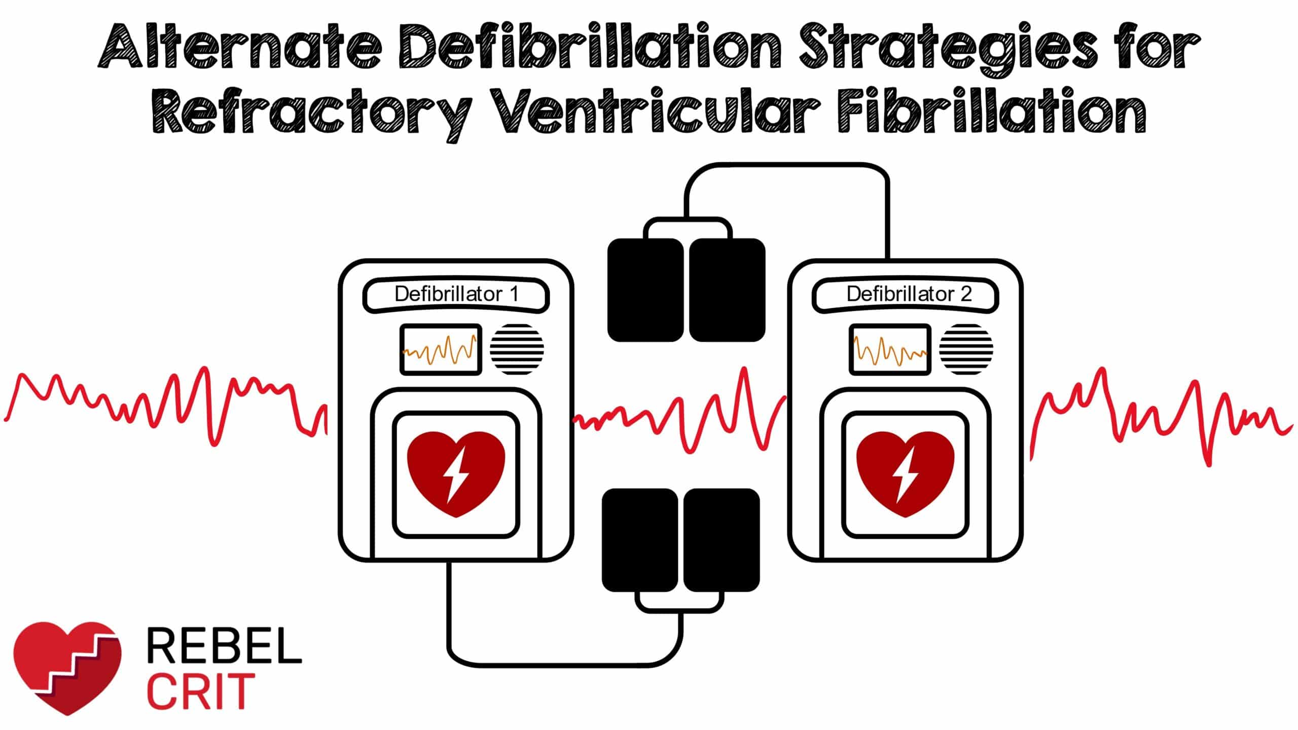 Alternate Defibrillation Strategies for Refractory Ventricular ...